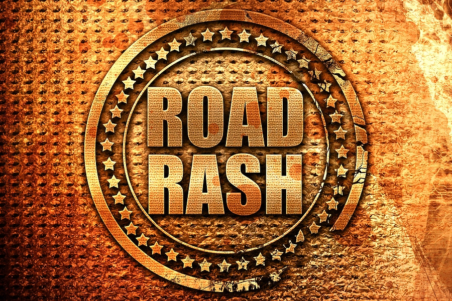 Heal road rash fast - easternloxa